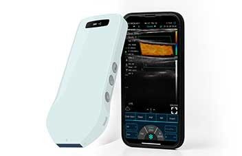 How To Use Handheld Wireless Ultrasound?