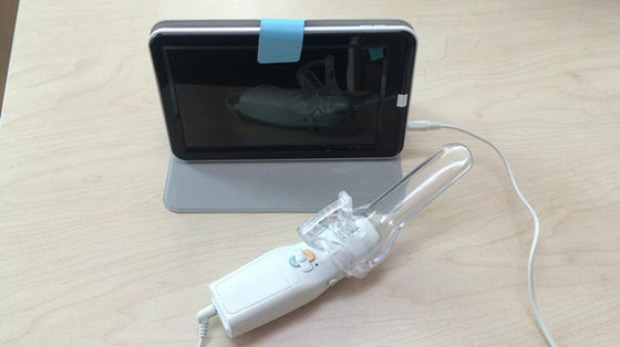 Vaginal Camera Cervix Camera Digital Electronic Video Colposcope for ...