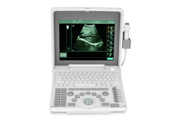 Digital Portable Mobile Laptop Ultrasound Scanner Medical Equipment BIO ...
