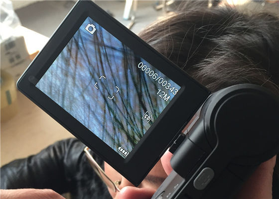 Hair And Skin Checker Video Dermatoscope Observing Skin And Hair With ...