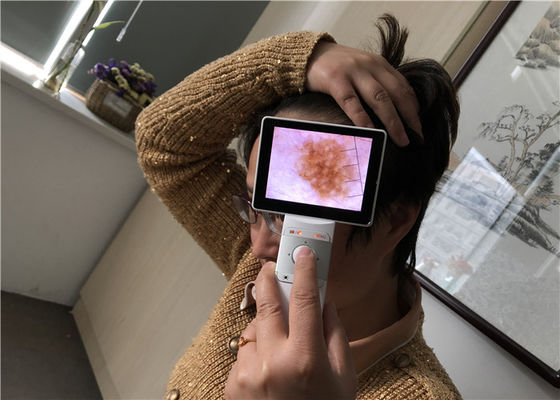 Wirelesss Optional USB Skin Camera Dermatoscope Video ENT Endoscope ...
