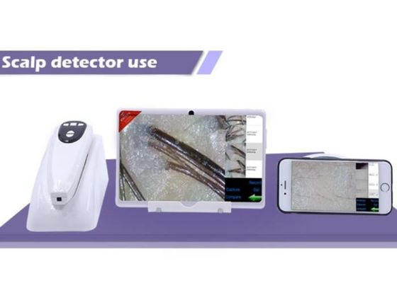 Digital Microscope for Skin and Scalp Video Dermatoscope with 2 Million ...