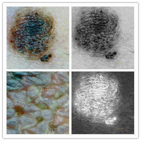 Skin Inspector Digital Microscope Skin Analyzer Skin and Scalp Camera ...