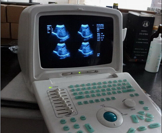 Smart Digital Portable Ultrasonic Equipment 10 inch CRT Stable Screen ...