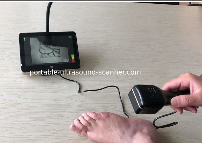 Medical Vein Viewing System Infrared Vein Locator Handheld Pocket Vein ...