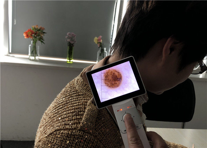 1920*1080 Pixels Resolution Video Dermatoscope Skin Hair Scanner ...