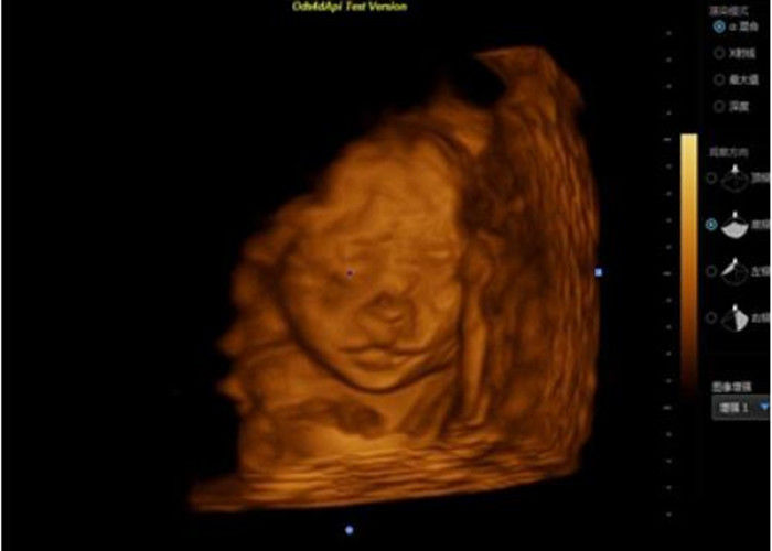 256 Level Full Digital 4D Color Doppler Machine With 15 Inch Touch Screen