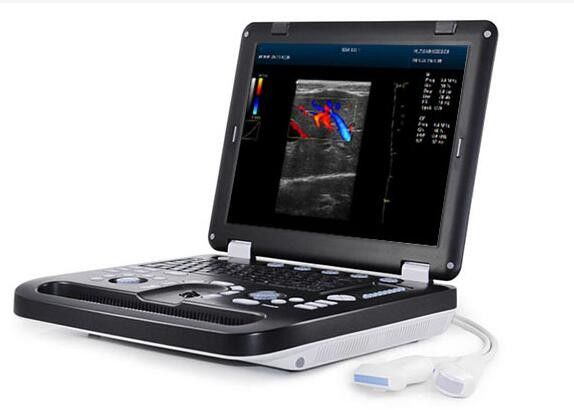 Digital Portable Ultrasound Scanner Movable Color Doppler With 15 Inch ...