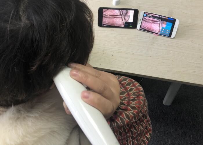 Medical Skin Analyzer Video Dermatoscope Skin Hair Analysis Machine ...