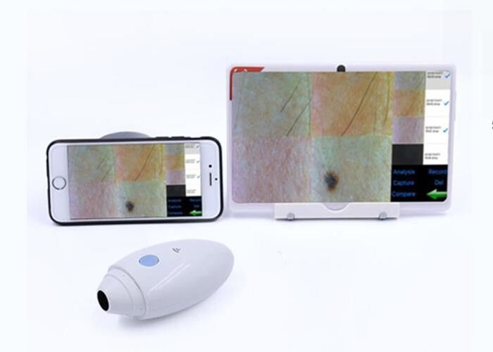 HD Digital Video Dermatoscope Skin Hair Scanner Wireless Connected to ...