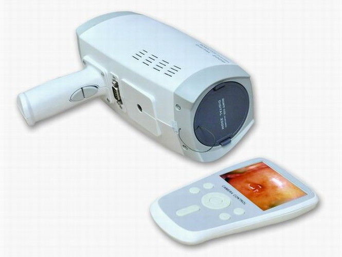 Lens Resolution 800000 Pixels Digital Electronic Colposcope With ...