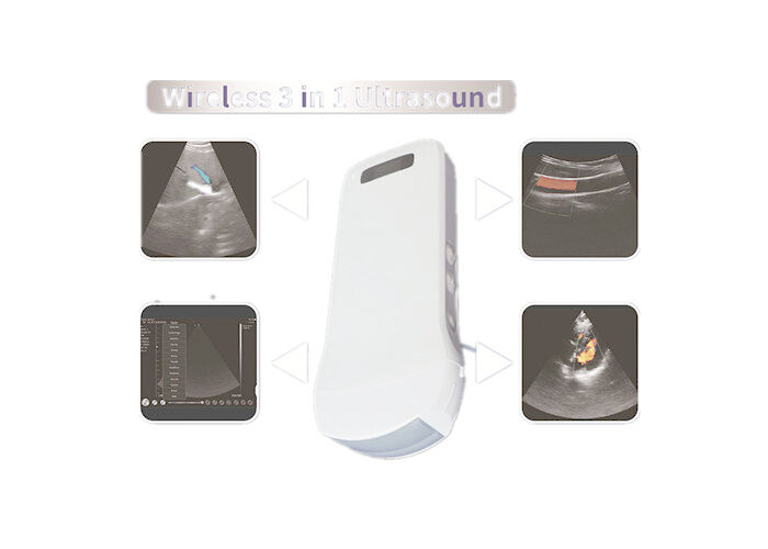 Color Doppler Sonography Color Doppler Ultrasound Scanner With Built In Wifi Signal Wireless