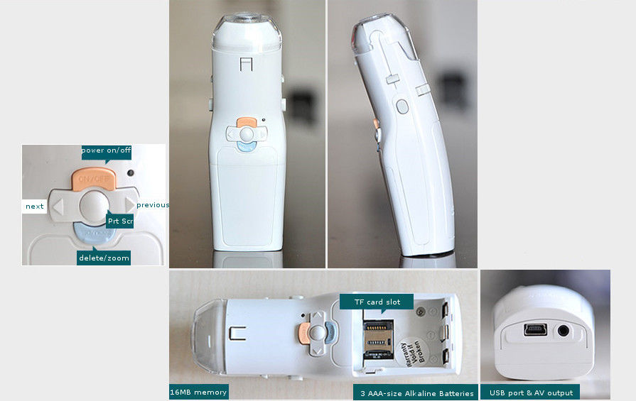 Handheld Mini Self-Inspector Digital Electronic Colposcope Vaginal ...