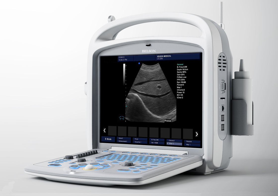 15 Inch LED screen Portable Ultrasound Scanner With 4D Imaging Function ...
