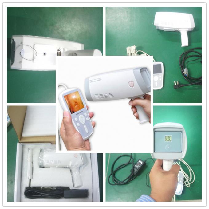 Digital Handheld Cervical Camera Colposcope for Gynecology to Inspect ...