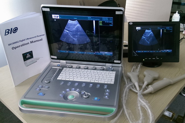 3D Digital B / W Portable Ultrasound Scanner With Convex Linear Transvaginal Probes