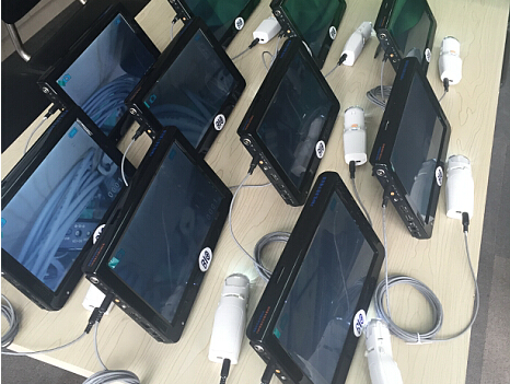 Cervix Camera Video Camera for Vaginal Handheld Digital Mini Colposcope ...