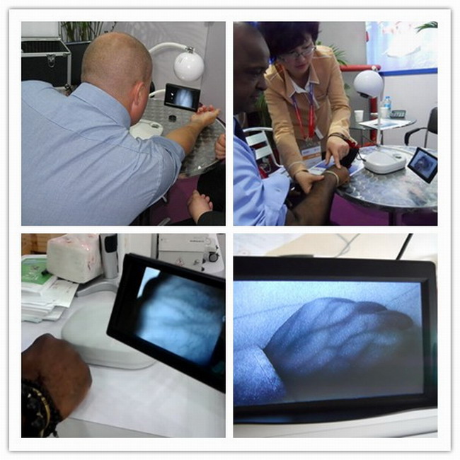 Vascular Images Displaying Veins In Screen Infrared Vein Finder For ...