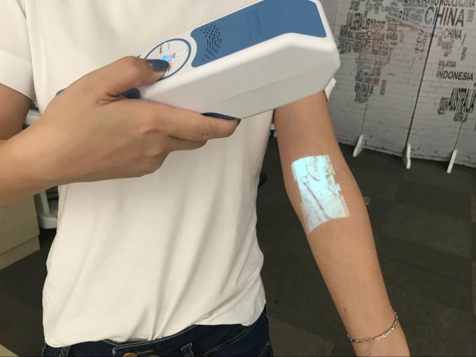 Portable Near-infrared Light Vein Detector Vein Scanner With 0.25mm ...