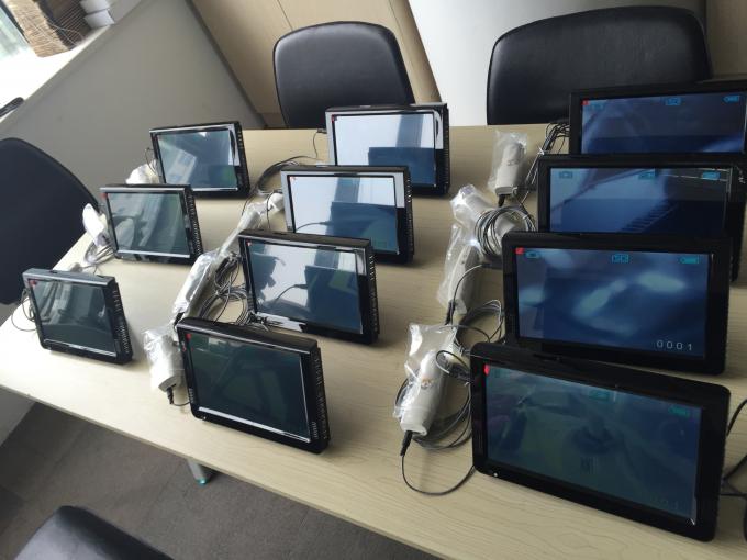 Pocket HD CCD Camera 100mm Colposcopy Machine