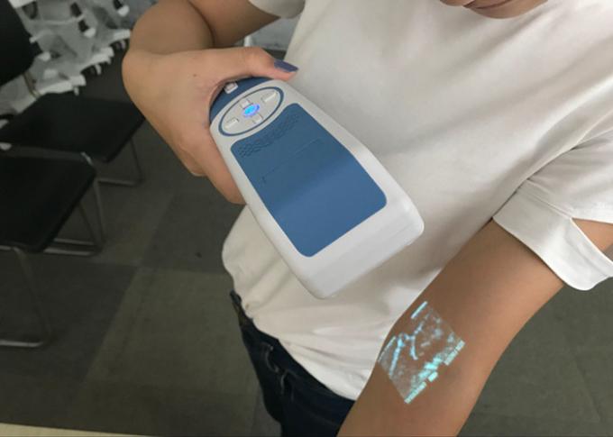 BS300 Medical Vein Viewing System Infrared Vein Finder Handheld Pocket ...