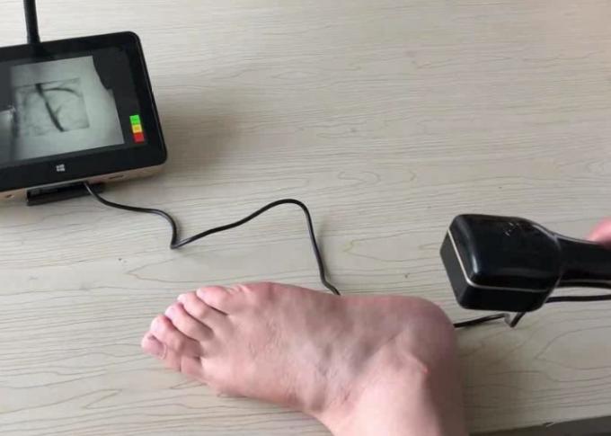 Medical Vein Viewing System Infrared Vein Locator Handheld Pocket Vein ...