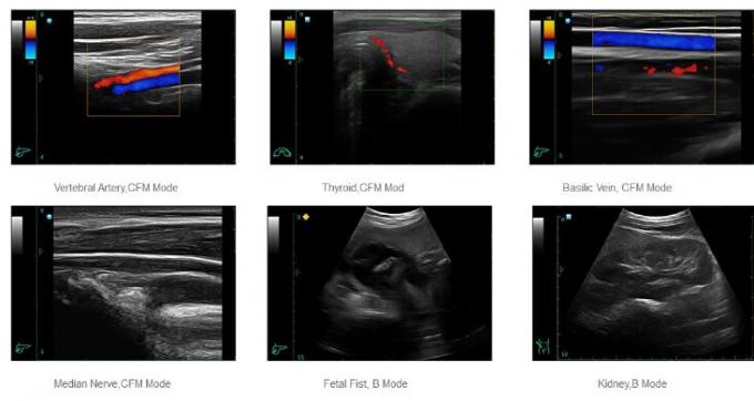2 Probe Connectors Portable Ultrasound Scanner With High Resolution CFM ...