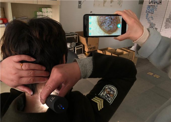 Wireless Video Dermatoscope Facial Skin Checker Skin Camera 1000 Times ...