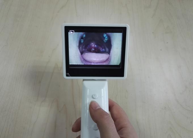 ENT Endoscopy Rhinoscopy Medical Video Camera Digital Otoscope For Nose ...