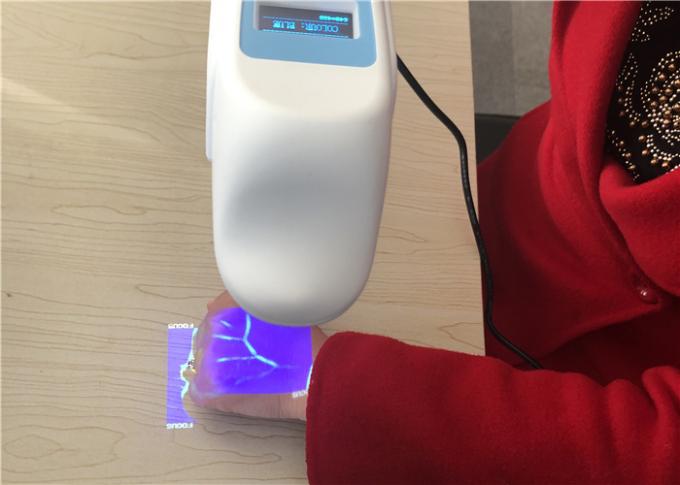 Mini Vein Locator Device Display A Map Of Vasculature On The Surface Of ...