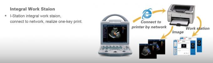 Full Digital Color Doppler Machine Color Ultrasound System Scanner With ...
