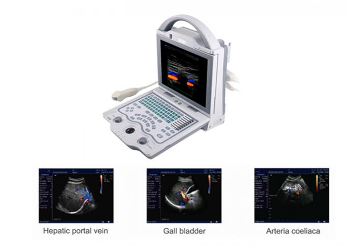 Full Digital Color Doppler Machine Ultrasound Scanner With 10.4 Inch ...