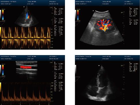 Professional Color Doppler Machine Ultrasound Scanner Equipment With ...