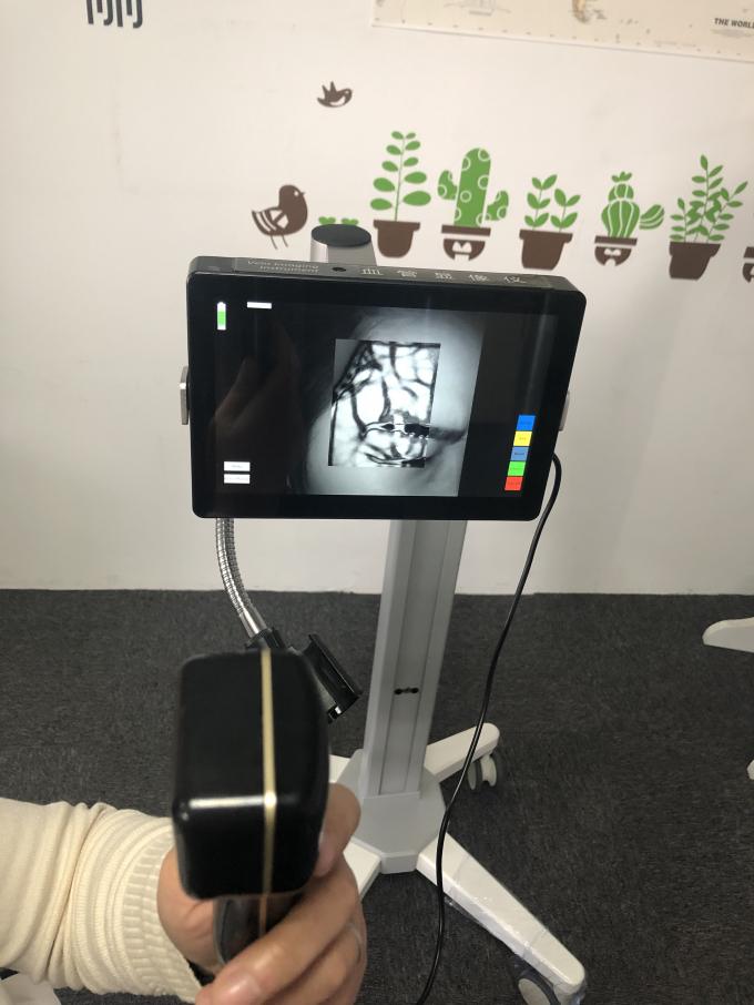 BS6000 Vein Viewing System Vein Locator Device With Led Light and 8 ...