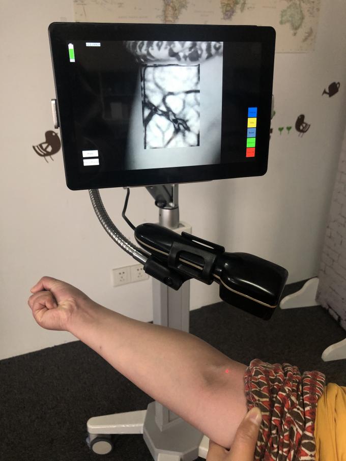 Medical Portable Vein Locator Device Spider Vein Removal Machine ...