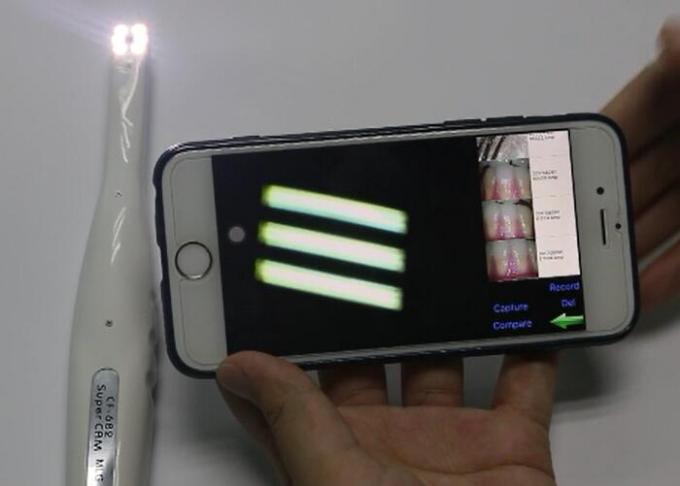 Wi-Fi Intraoral Camera Digital Video Otoscope Camera Tooth Camera with ...