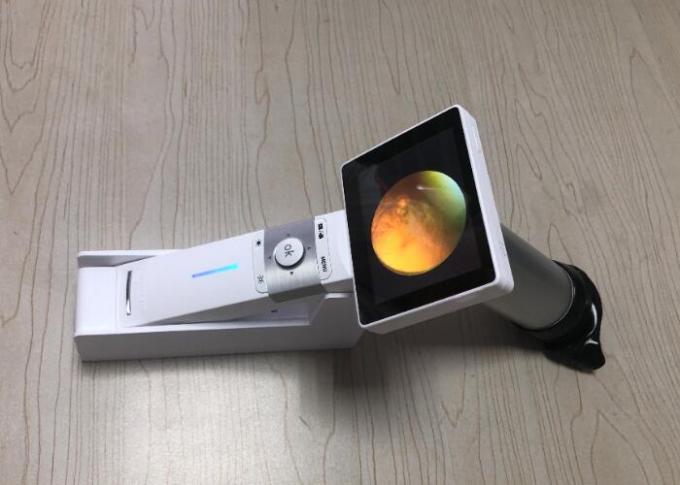 Light Weight Portable Ophthalmoscope Digital Handheld Fudus Camera FOV ...