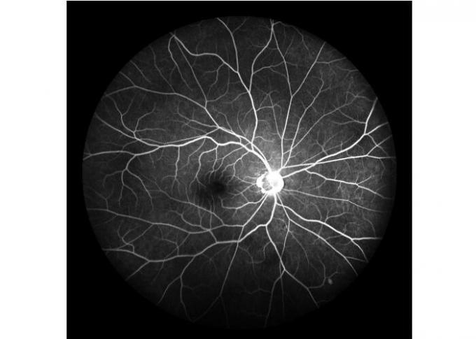 Laser Scanning Fundus Camera Professional Opthalmic Equipment With ...