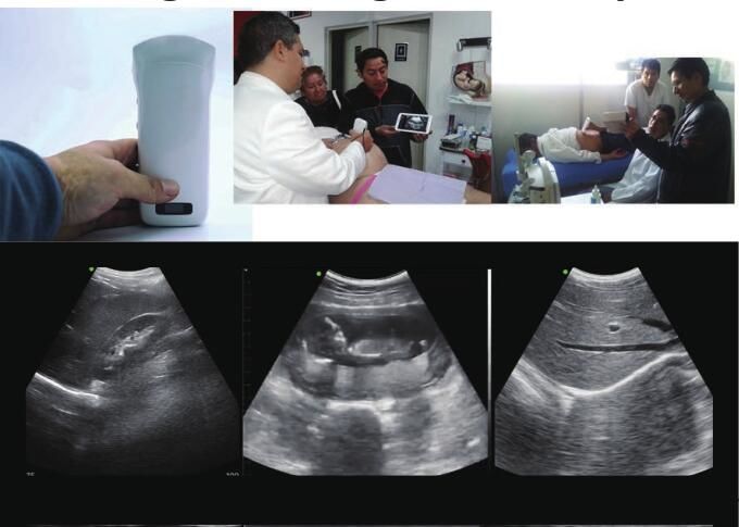 Palm Ultrasound Tranducer Handheld Ultrasound Machine With 128 Elements ...