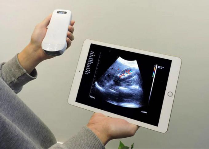 Pocket Handheld Ultrasound Scanner With Wifi Connected To IPad ...
