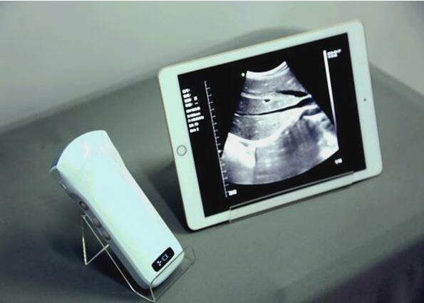 Affordable Wireless Portable Ultrasound Handheld Ultrasound Scanner 5G ...