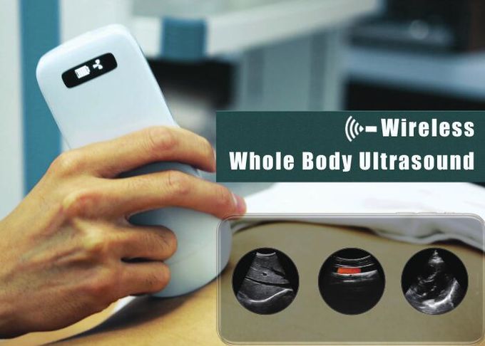 Digital Wireless Handheld Ultrasound Scanner Wifi Connection Cardiac ...