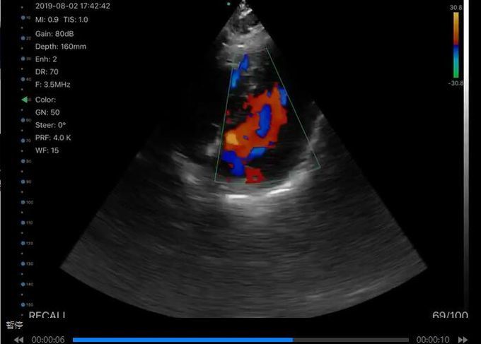 Colour Doppler Ultrasound Scanner Doppler Ultrasound Device With 128 ...