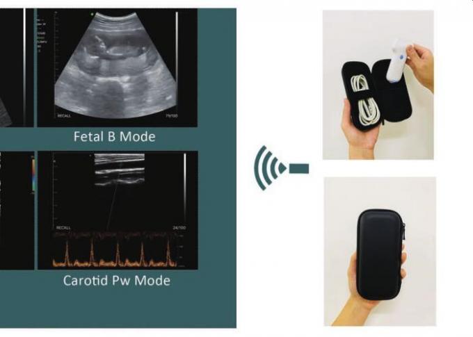 Wifi 20-305mm Depth Hand Ultrasound Machine USB Ultrasound Probe