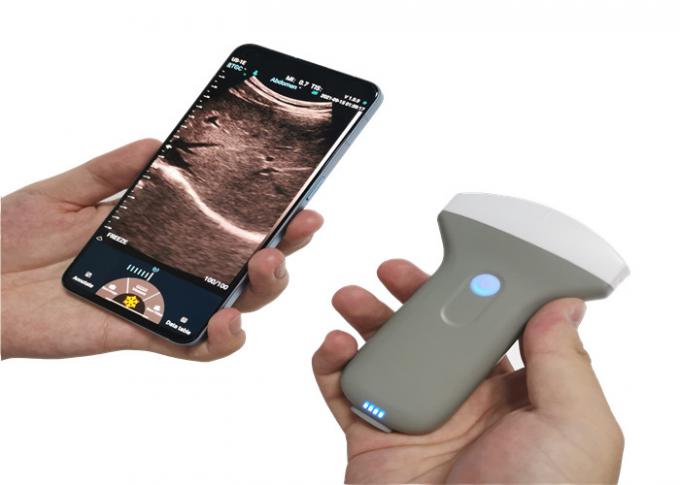 Medical Handheld Ultrasound Scanner Wifi Depth Of 90mm 5MHz Convex