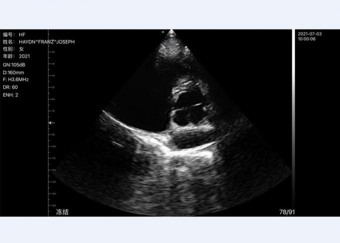 2.2MHz Mobile Portable Ultrasound Scanner Linear+Cardiac Probe 7.5/10MHz