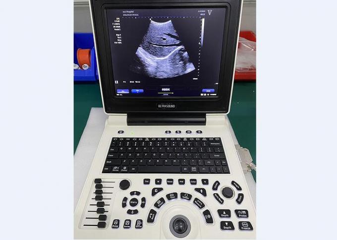 12MHz Color Doppler Ultrasound System Device With PW PDI Functions