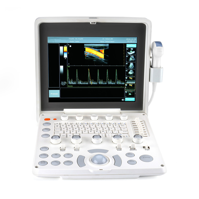 12.1-inch LED Monitor Portable Ultrasound Scanner Color Doppler Machine ...