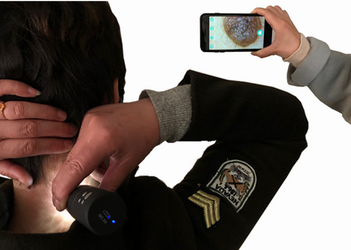 WIFI Skin Analyer Digital Video Dermatoscope Skin Watcher With 2 ...