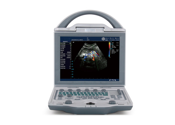 Portable Echocardiography Machine Portable Ultrasound Scanner With 10.4 ...